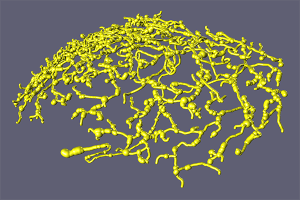 Erik Meijering - Research