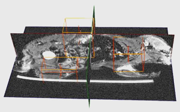 Erik Meijering - Research